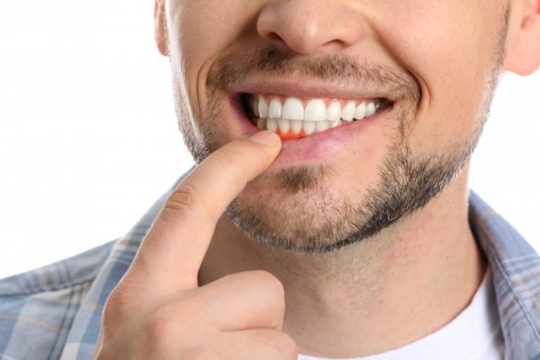 7 Reasons Why You May Have A Bump On Your Gums 7-reasons-why-you-may-have-a-bump-on-your-gums
